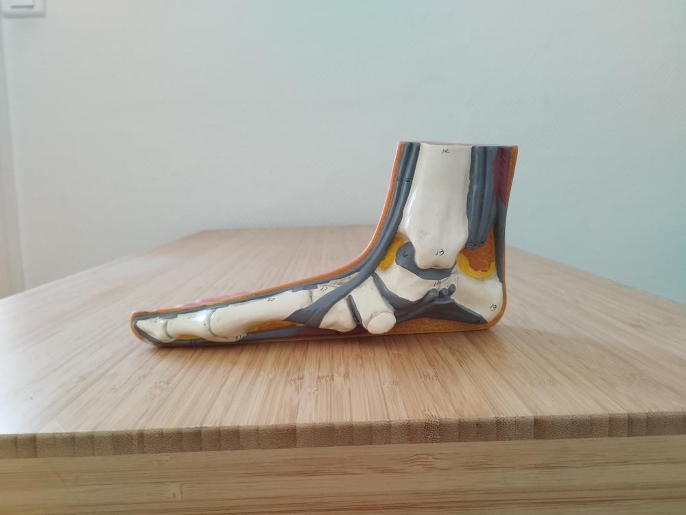 Aponévrose plantaire : causes, symptômes, traitements et épine calcanéenne