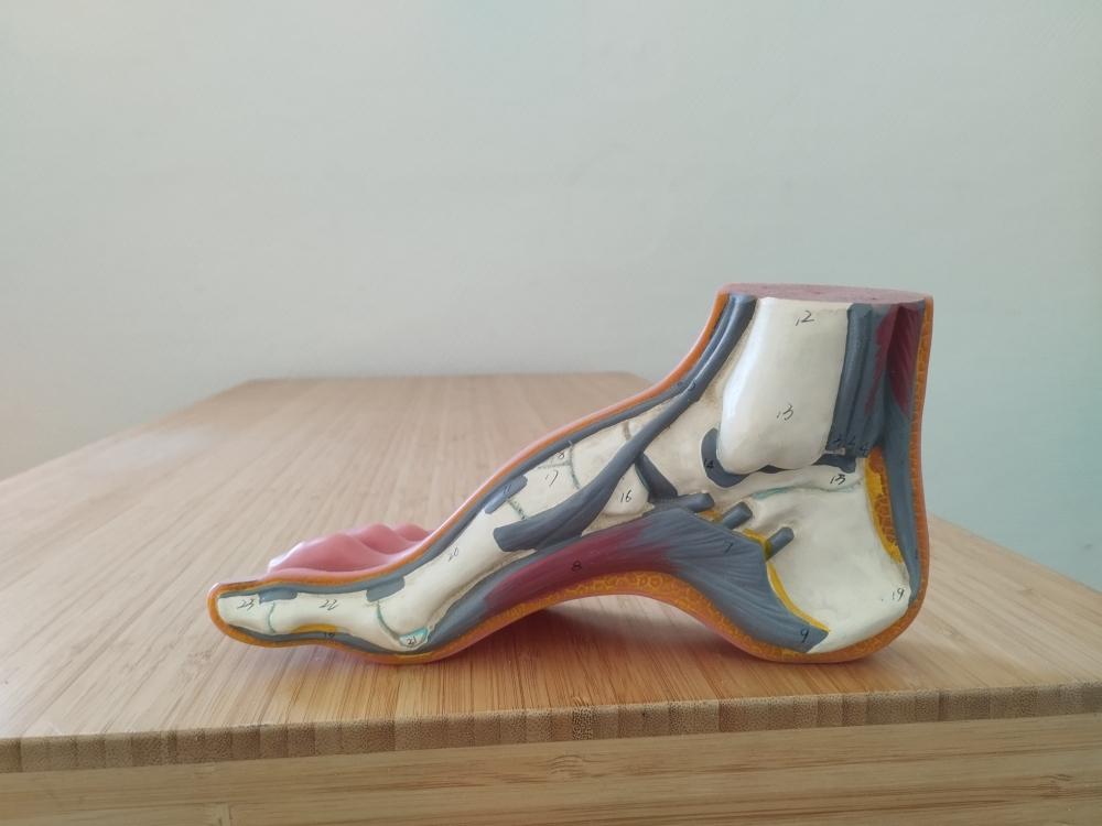 Aponévrose plantaire : causes, symptômes, traitements et épine calcanéenne